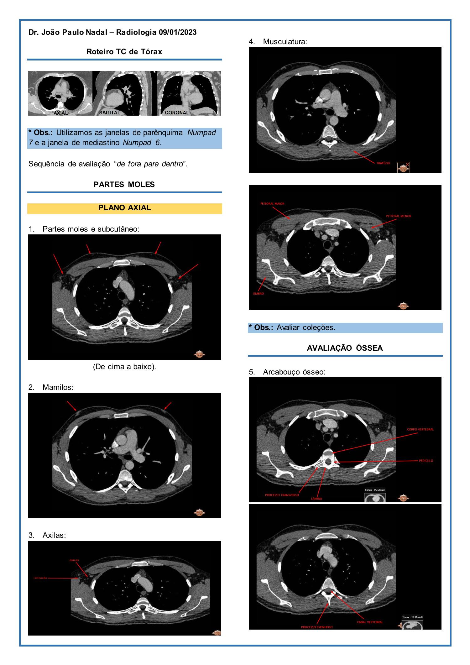 Roteiro TC de Tórax.pdf | DocDroid