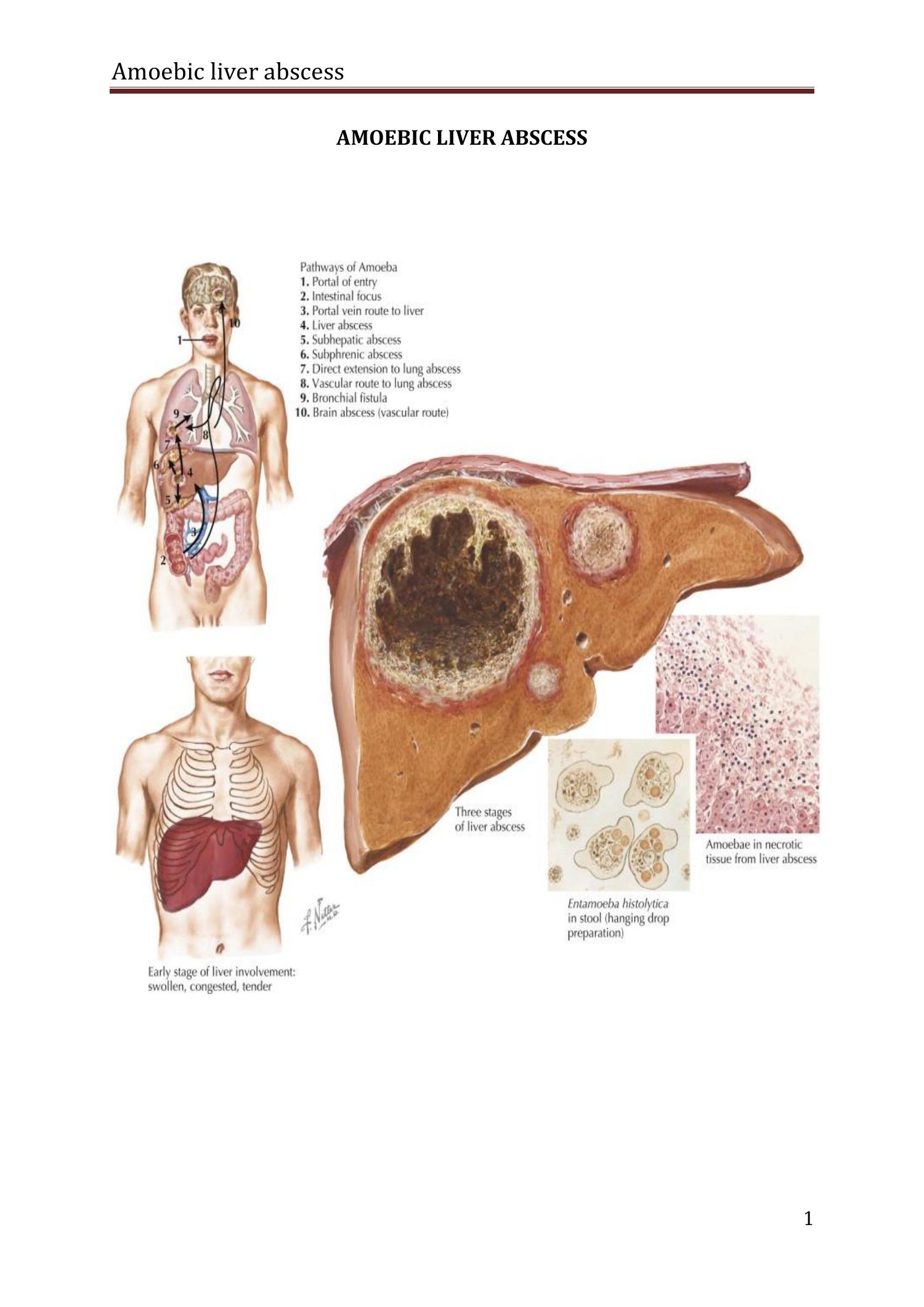 AMOERIC LIVER ABSCESS.doc | DocDroid