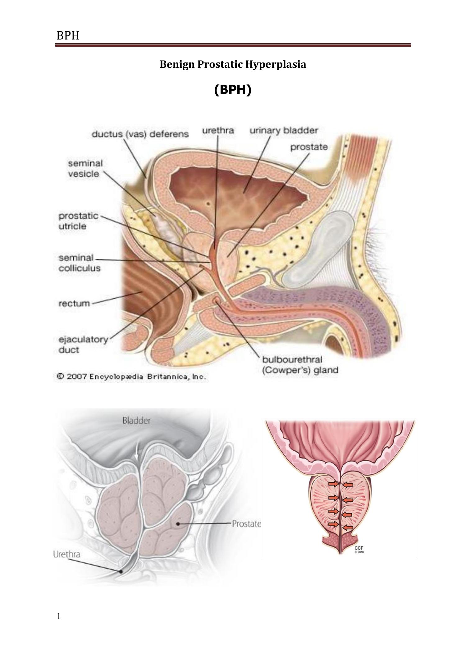 Urosurgery-BPH.doc | DocDroid