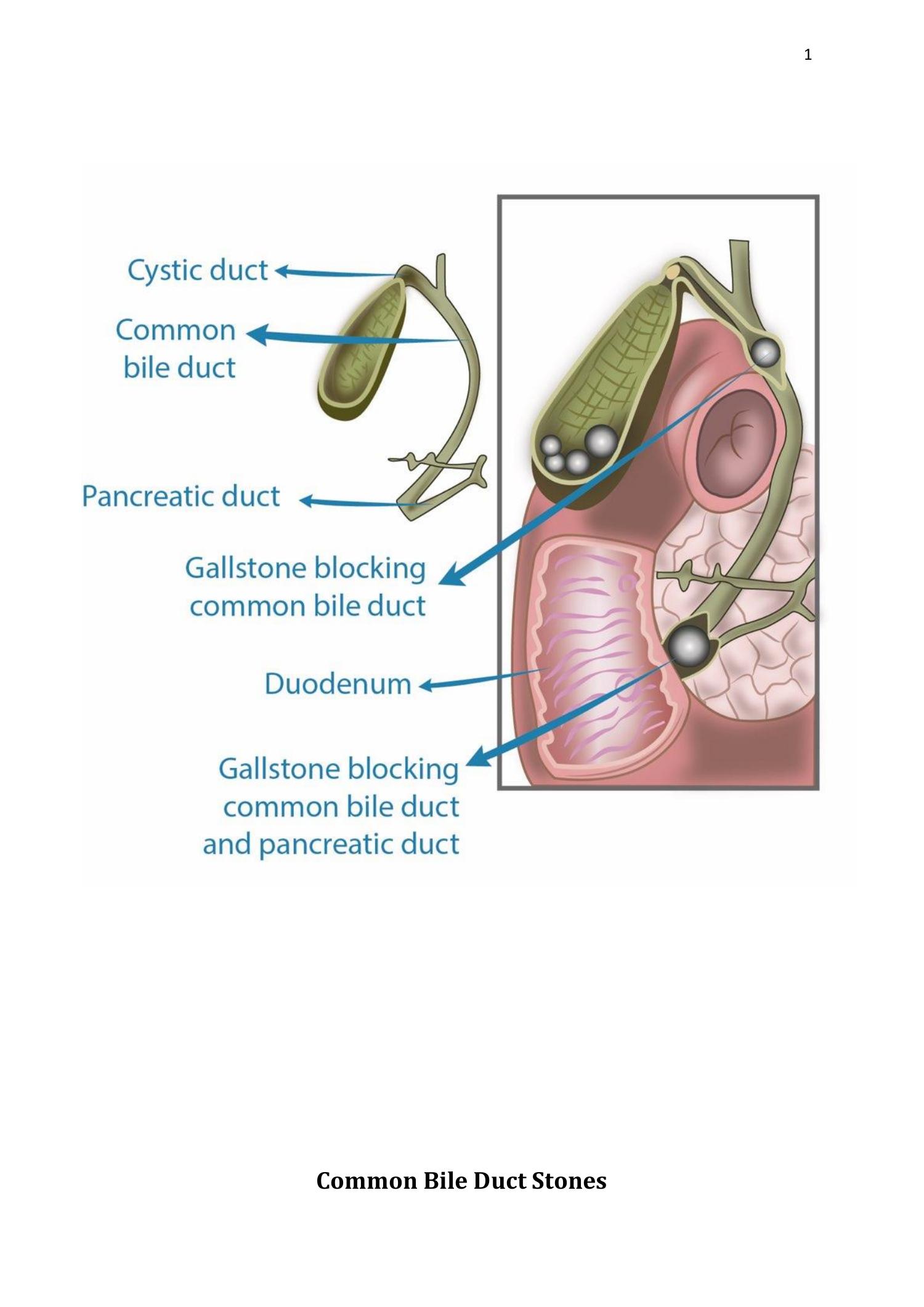GIT surgery CBD Stones.doc | DocDroid