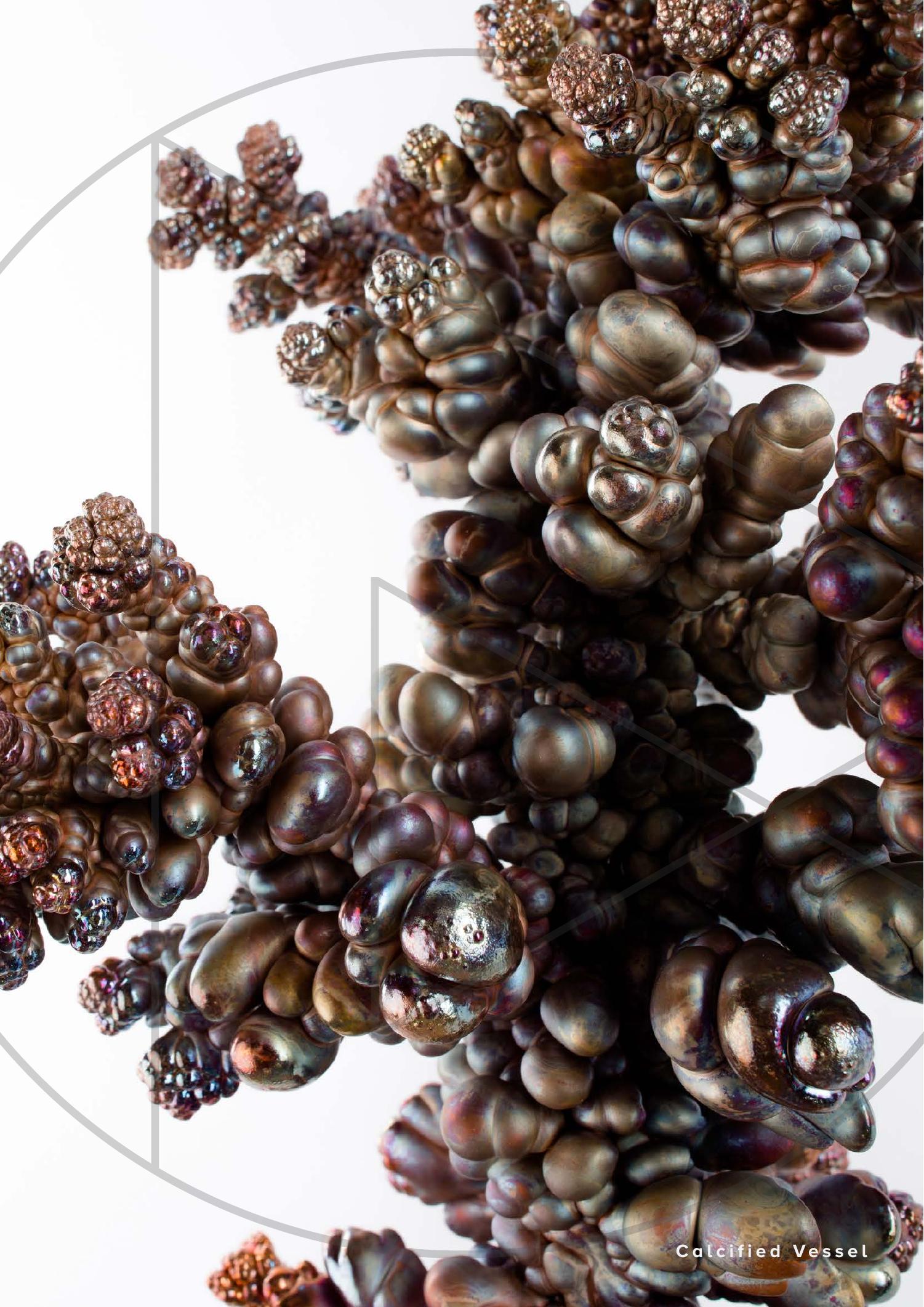 Calcified Vessel.pdf | DocDroid