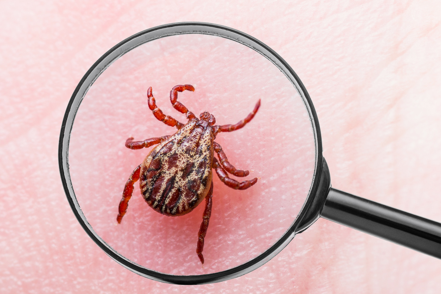 Wunderbar Symptome Von Borreliose Bilder