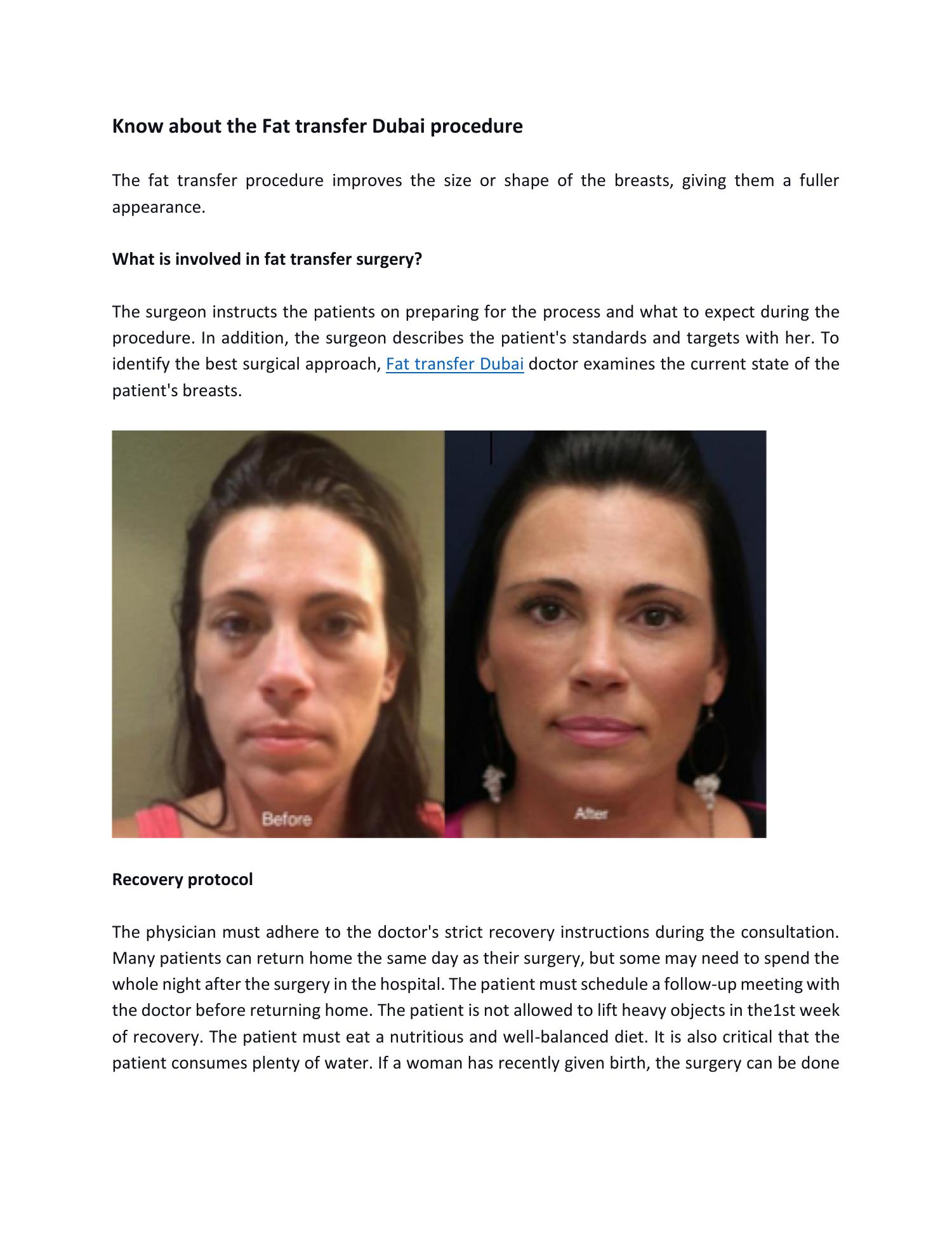 Know about the Fat transfer Dubai procedure.pdf | DocDroid