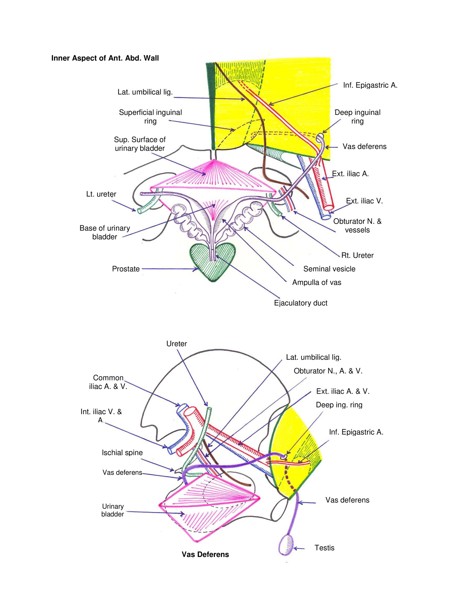 Inguinal Hernias Direct And Indirect Inguinal Hernias