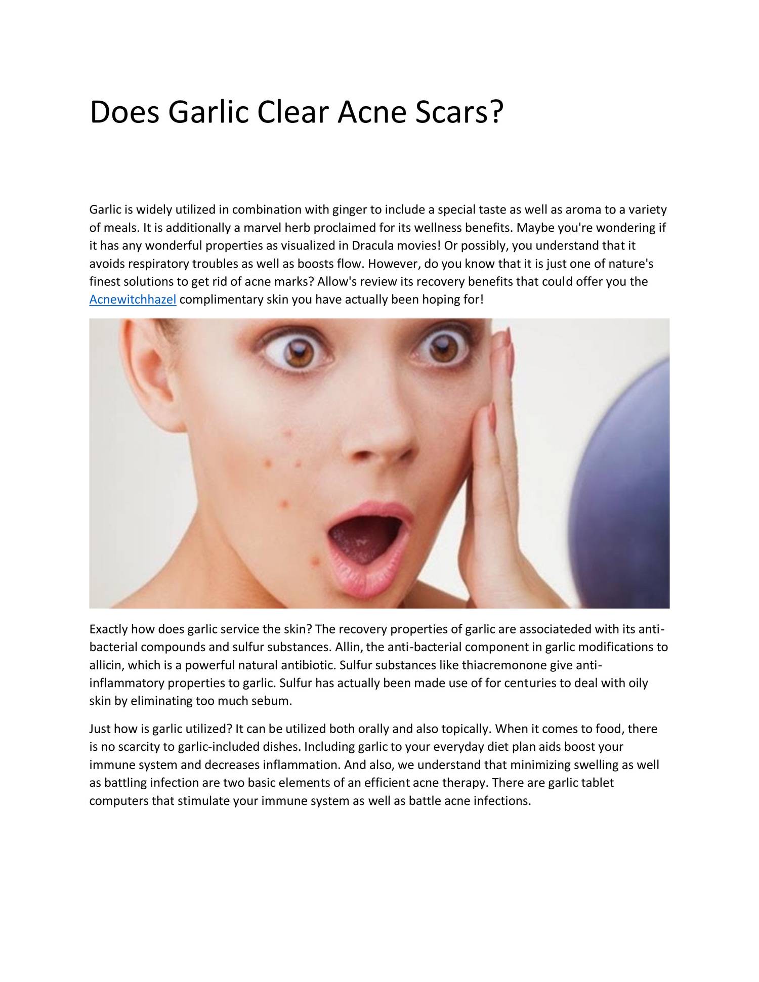 Does Garlic Clear Acne Scars.pdf | DocDroid