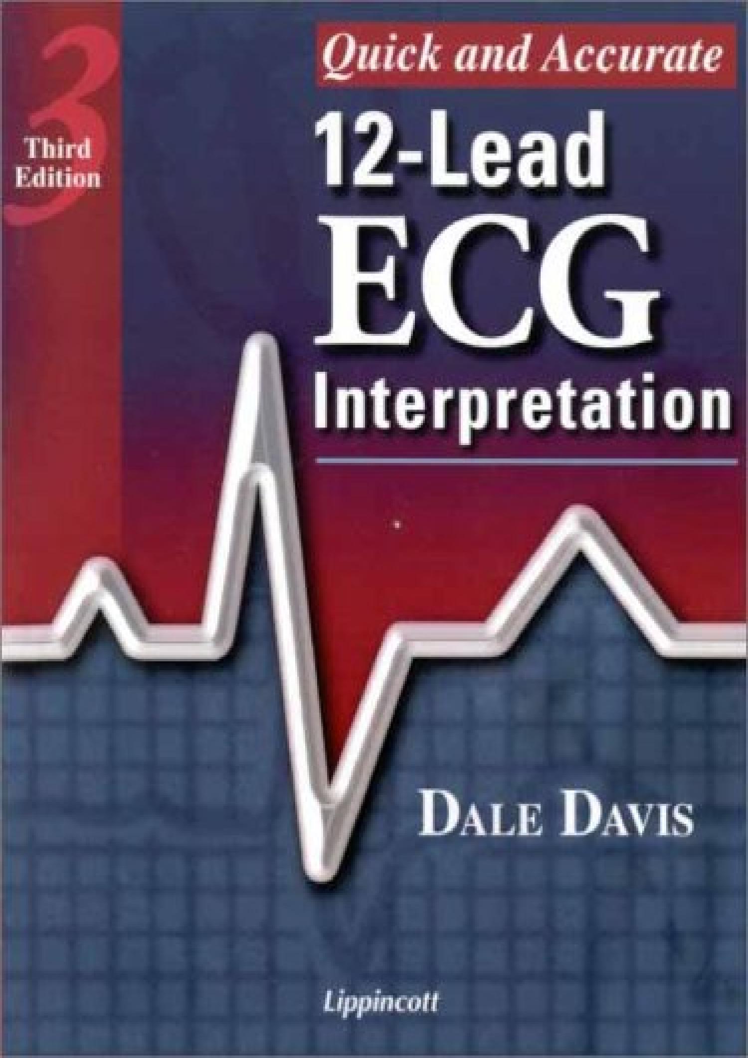DOWNLOAD Quick and Accurate 12 Lead Ecg Interpretation.pdf | DocDroid