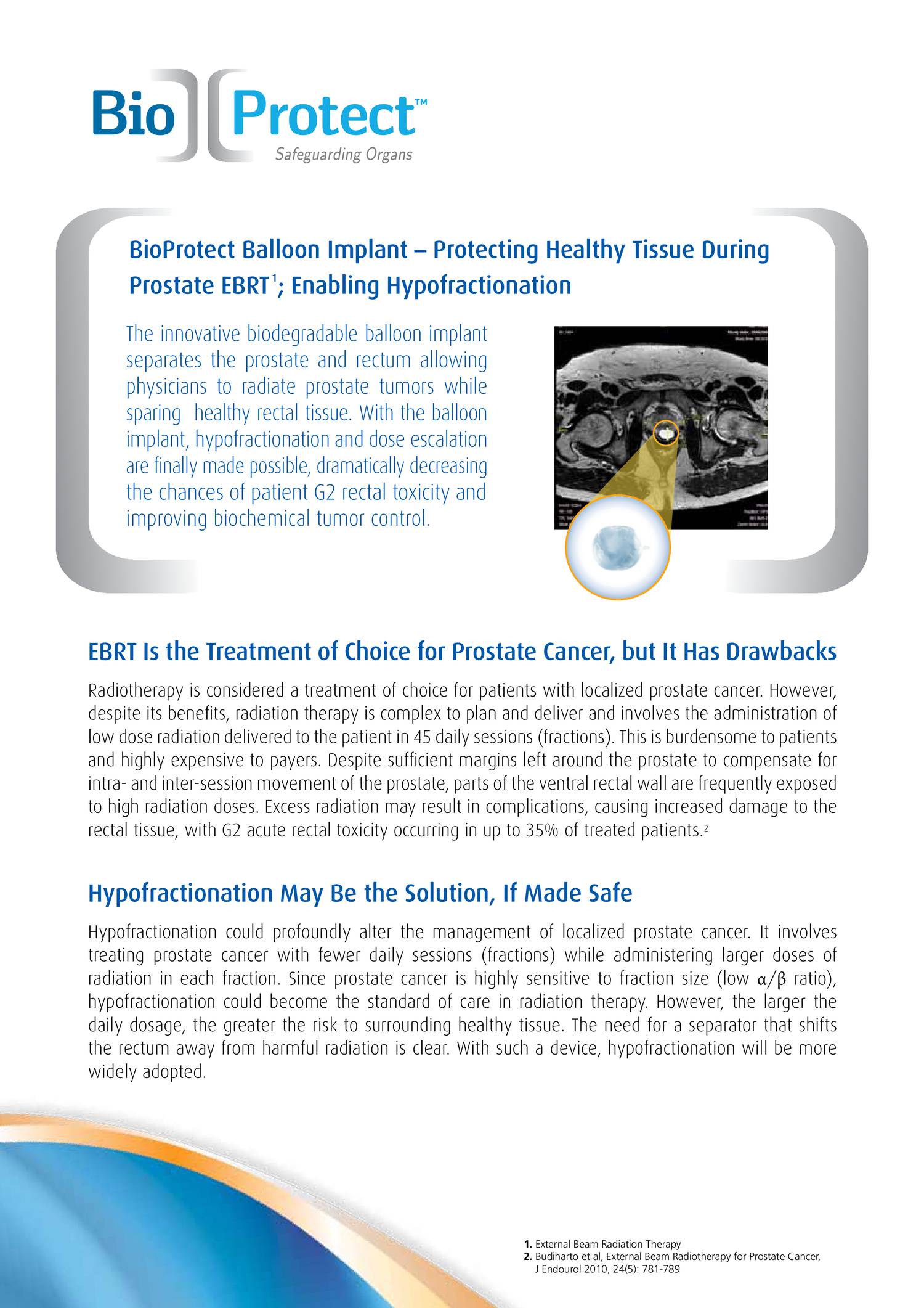 Prostate-Balloon-Implant-Datasheet-READ.pdf | DocDroid