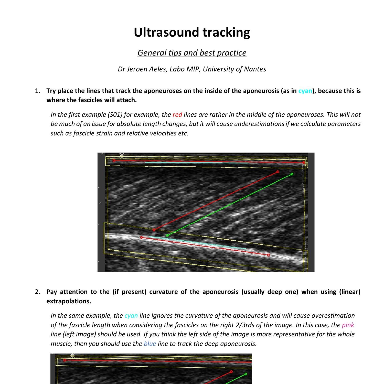 Ultrasound tracking-general guidelines.pdf | DocDroid