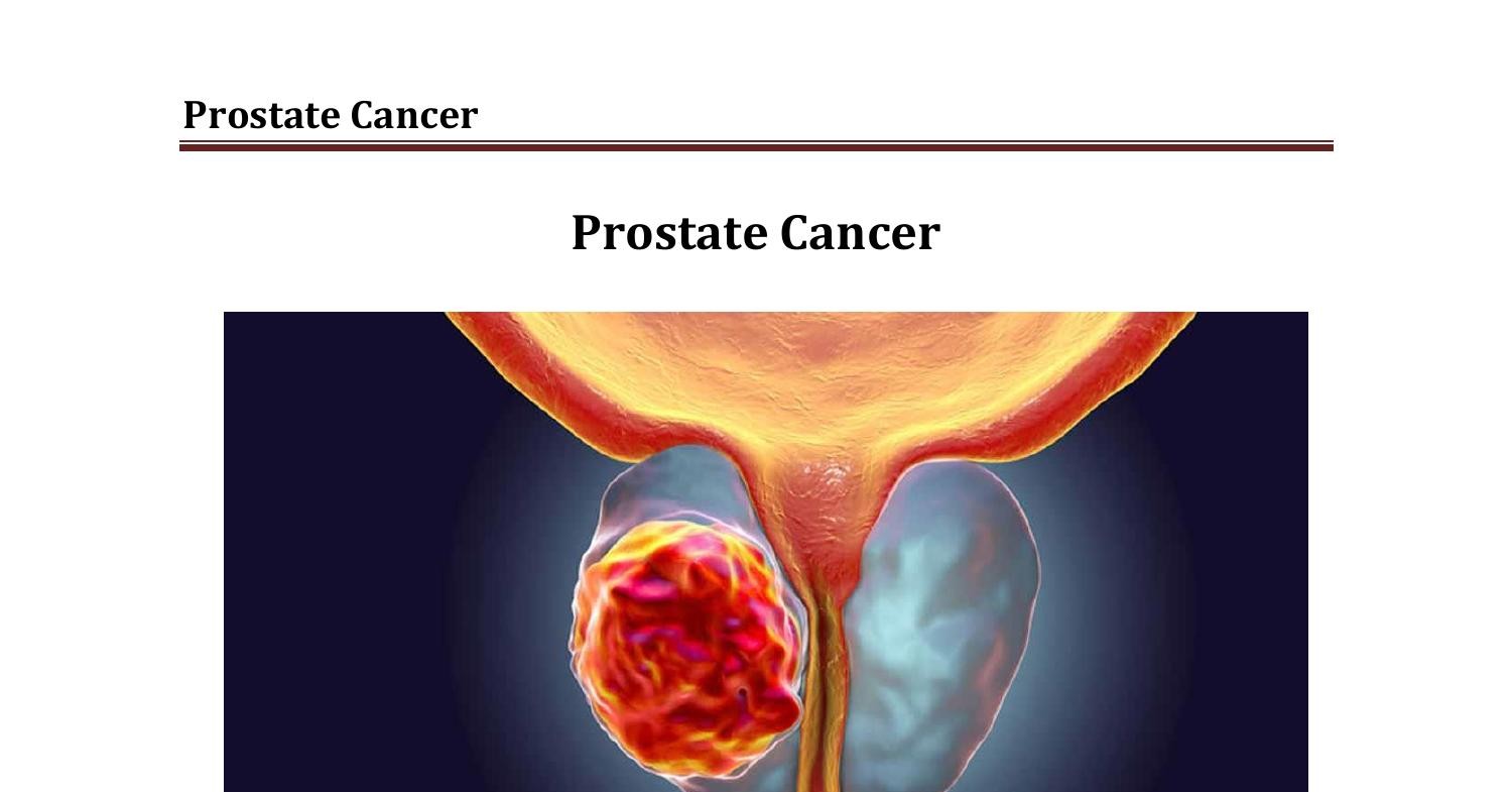 Urosurgery -Prostate Cancer.doc | DocDroid