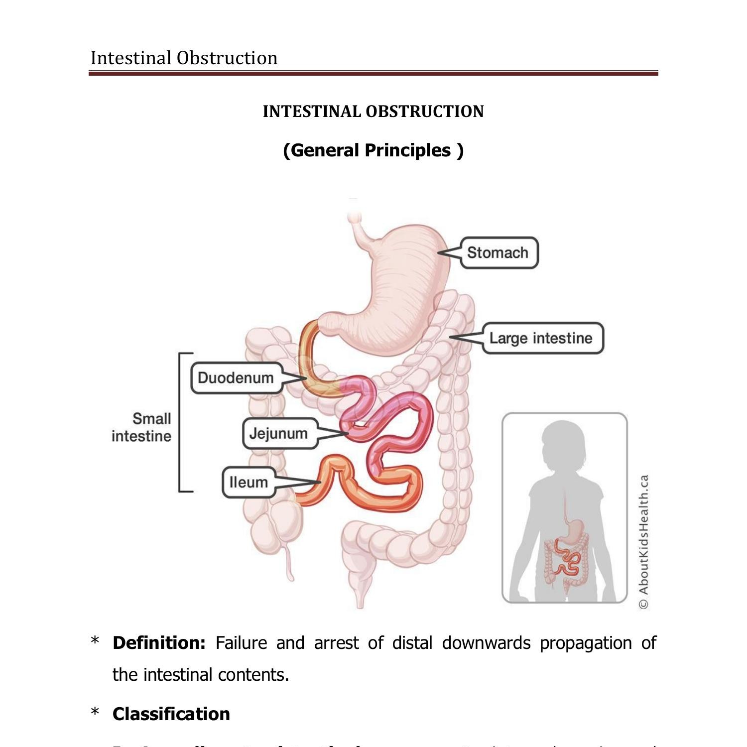 INTESTINAL OBSTRUCTION.doc | DocDroid