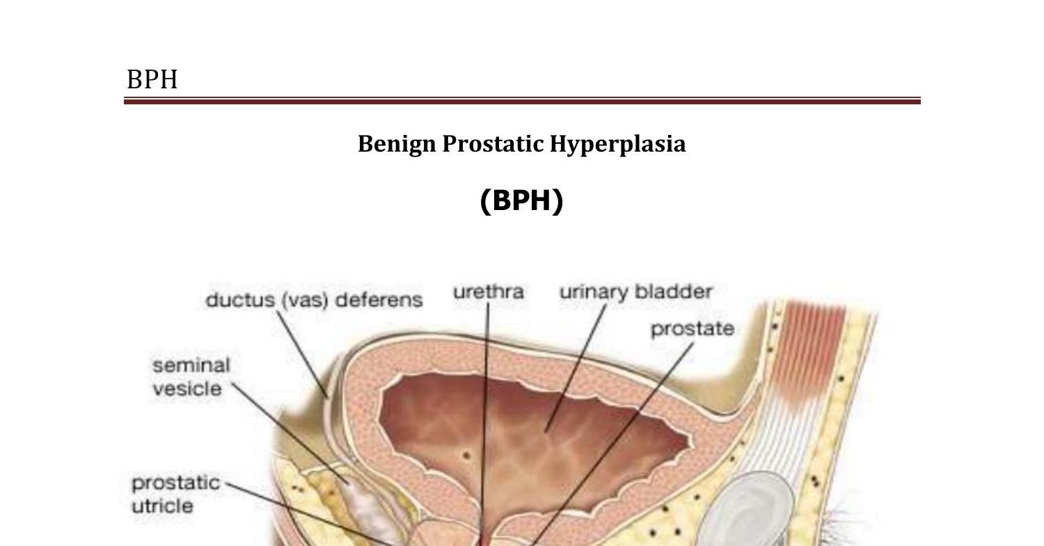 Urosurgery-BPH.doc | DocDroid