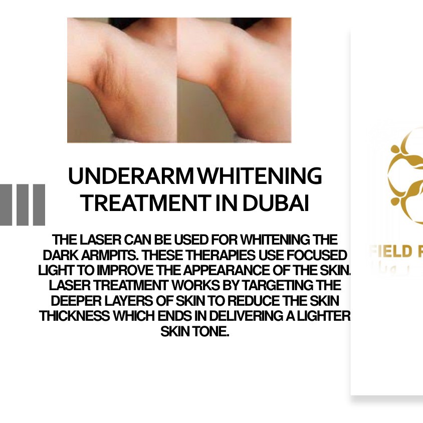 Underarm Whitening Treatment in Dubai.pptx | DocDroid