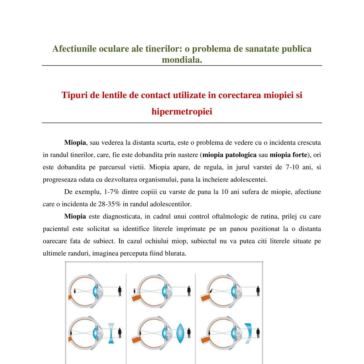 lentile de contact tratare miopiei si hipermetropia.pdf | DocDroid