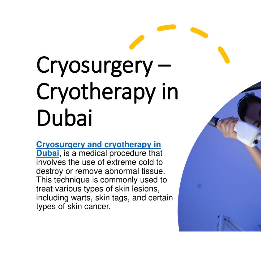 Cryosurgery – Cryotherapy in Dubai.pptx | DocDroid