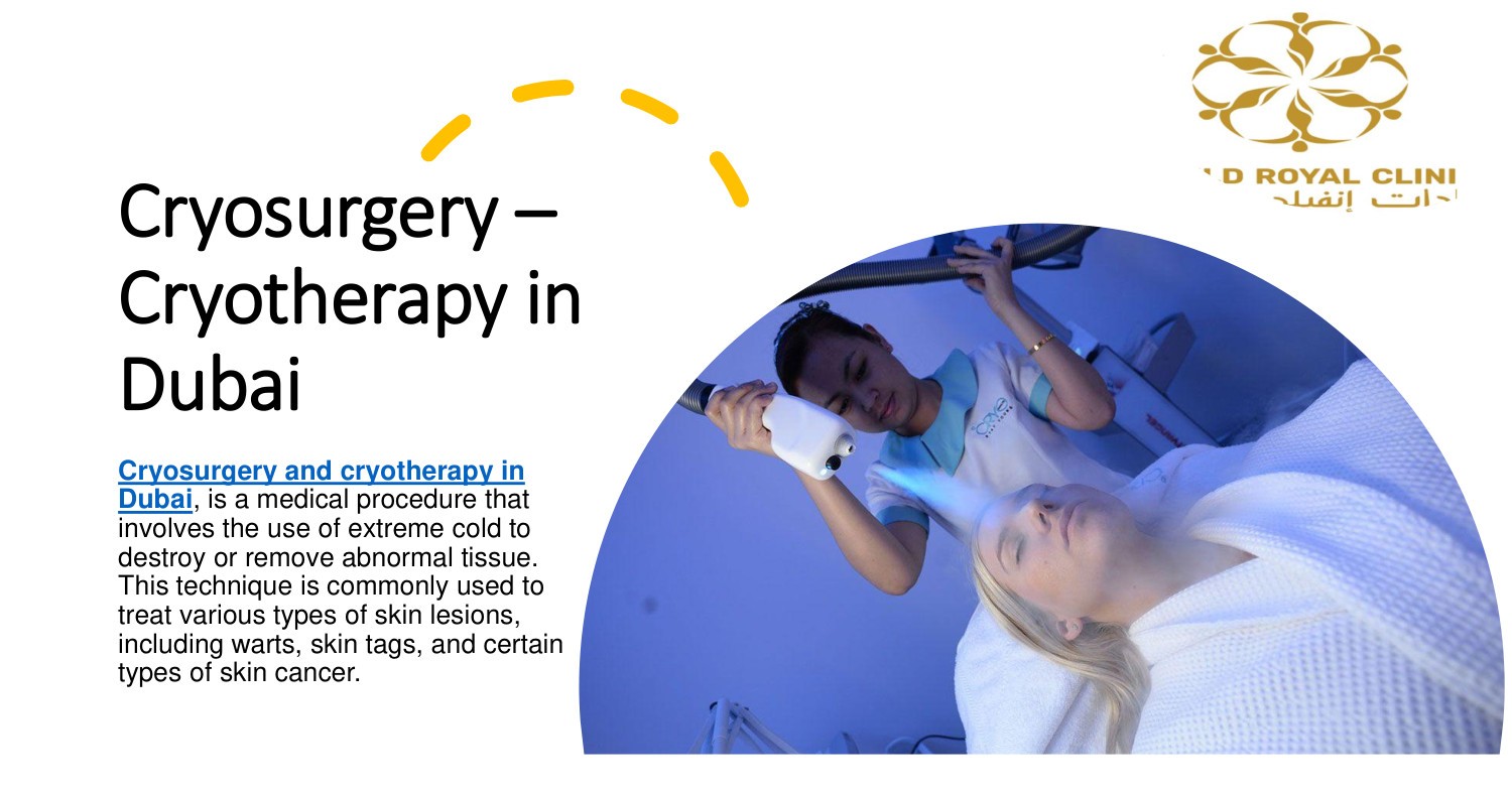 Cryosurgery – Cryotherapy in Dubai.pptx | DocDroid