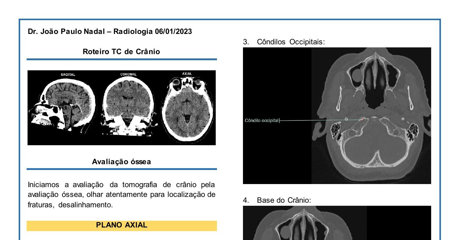 Roteiro TC de Crânio.pdf | DocDroid
