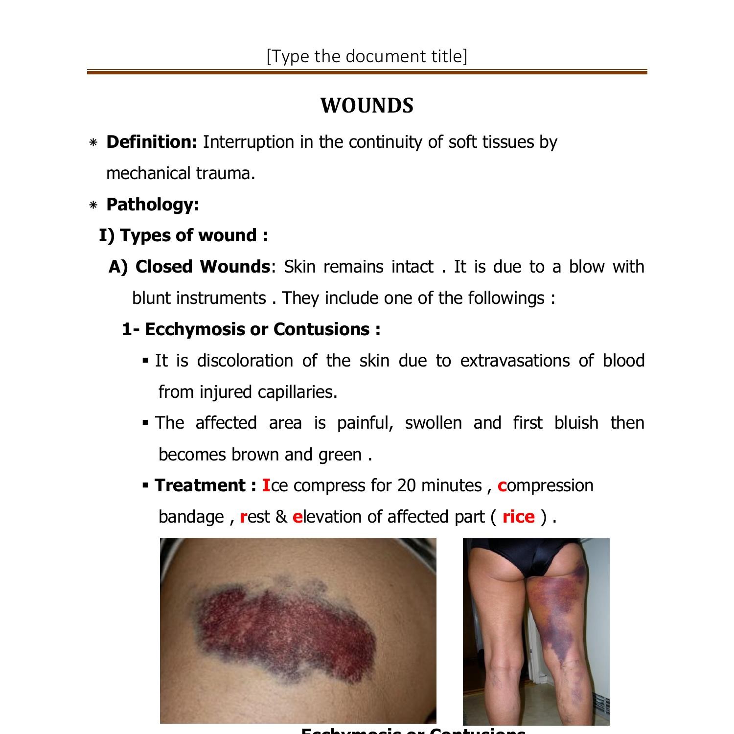 Wounds.doc | DocDroid