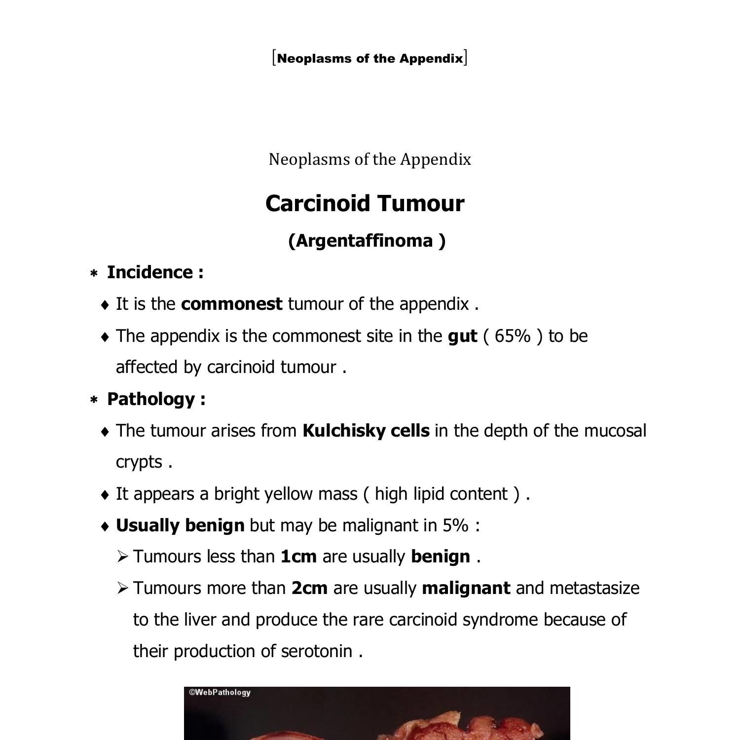 Neoplasms of the Appendix.doc | DocDroid